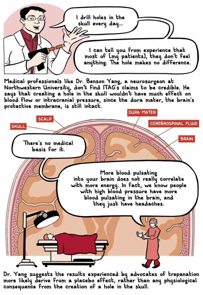 Trepanation: Elective Surgery You Need Like A Hole in the Head | The Nib